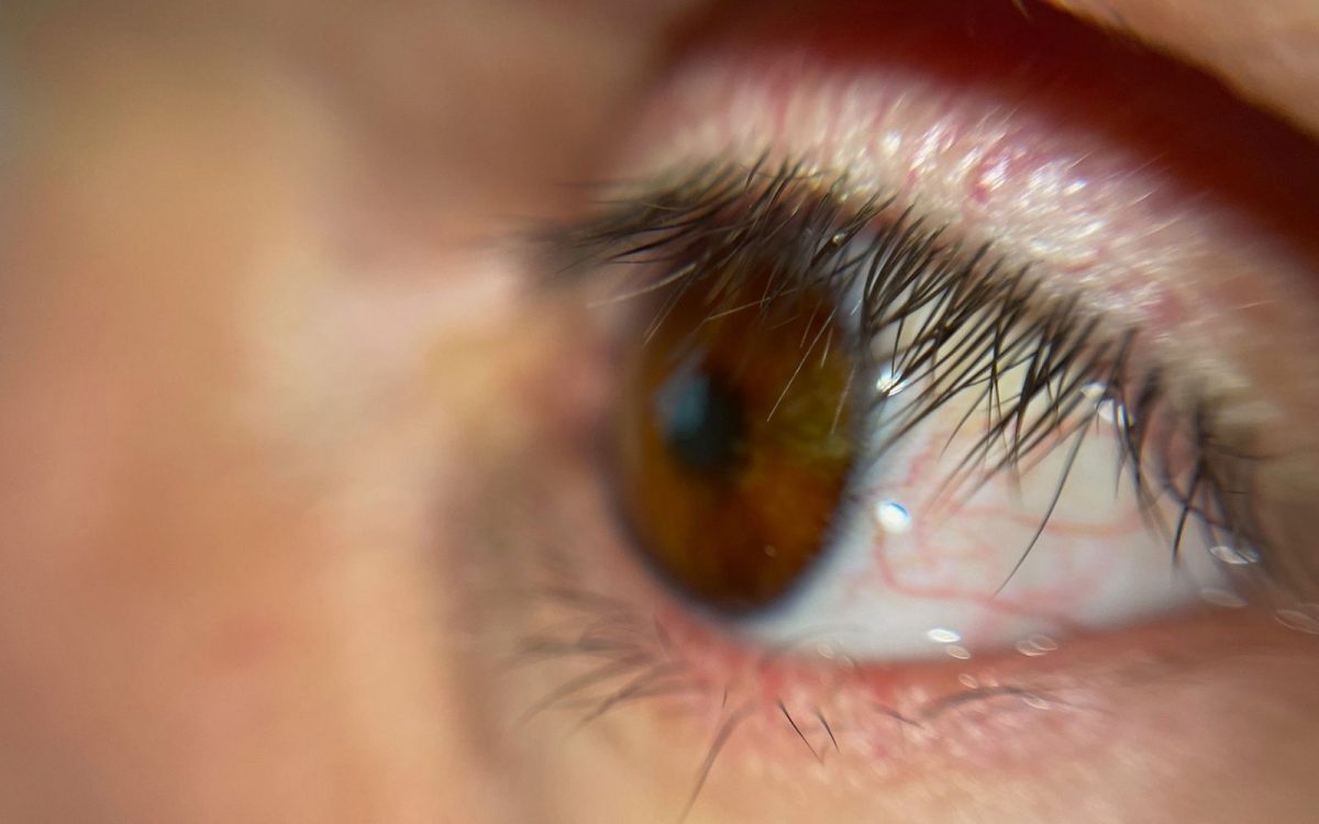 Scientists Fit Patient With World's First Fully Digital 3D-printed ...