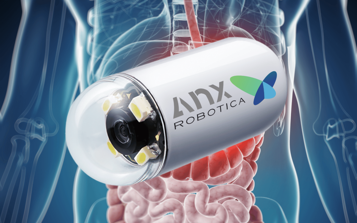 The NaviCam Is A Remote Controlled Camera That You Swallow (for Medical Reasons) - Stuff South ...